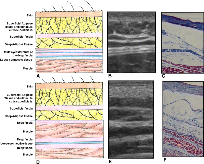 Fascia redefined: anatomical features and technical relevance in ...