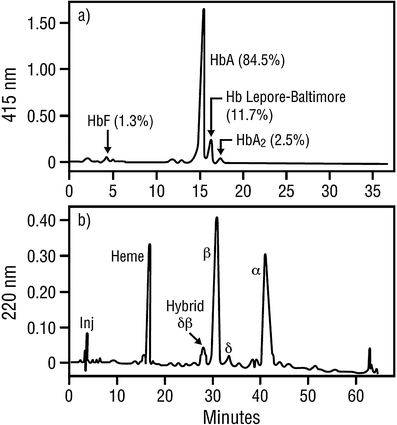 Rare occurrence of Hb Lepore-Baltimore in African Americans: molecular ...