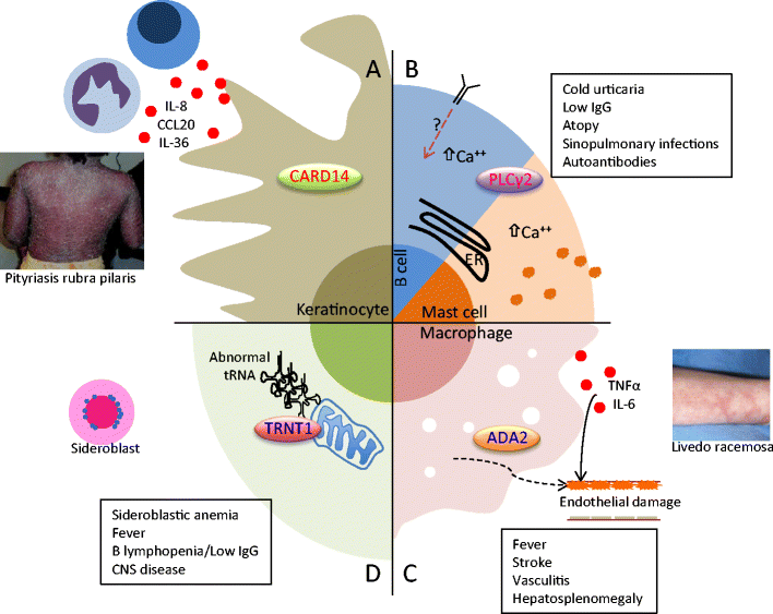 New monogenic autoinflammatory diseases—a clinical overview | SpringerLink