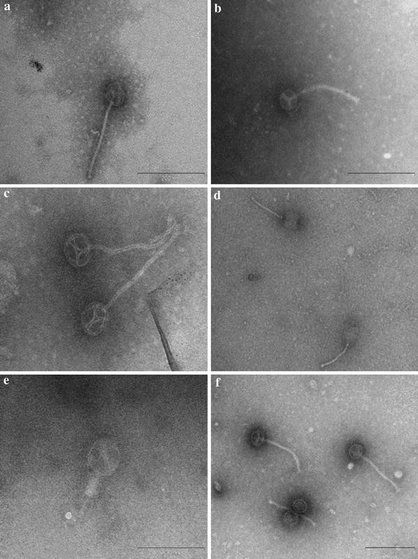 Novel Bacteriophages in Enterococcus spp. | SpringerLink