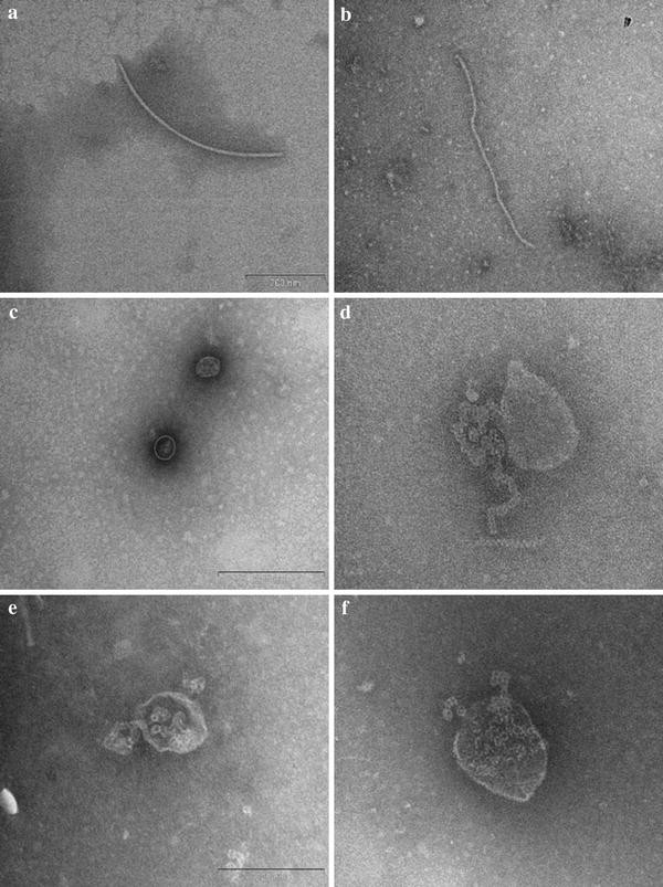 Novel Bacteriophages in Enterococcus spp. | SpringerLink