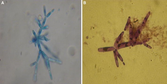 Isolation and Characterization of Cyniclomyces guttulatus (Robin) Van ...