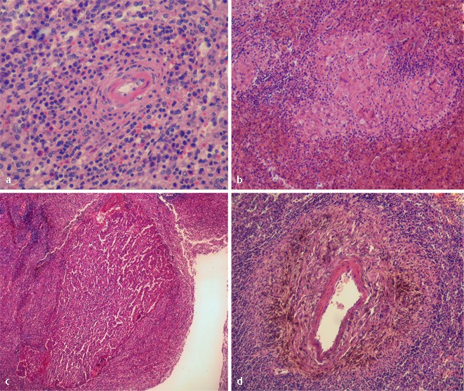 Milzruptur | SpringerLink