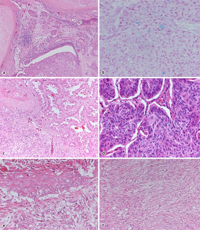 Karzinome der Lunge | SpringerLink