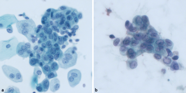Das Paris-System zur Klassifikation der Urinzytologie | SpringerLink