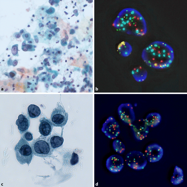 Das Paris-System zur Klassifikation der Urinzytologie | SpringerLink