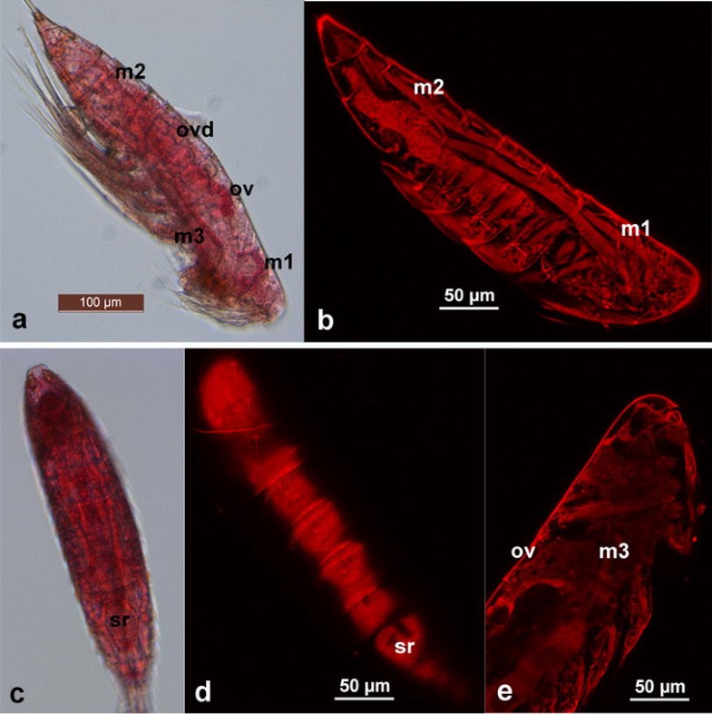 Female gonad morphology of small copepods Oithona similis and ...