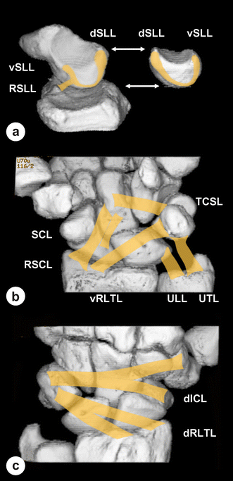 Carpal instability | SpringerLink