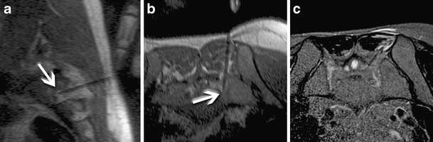 Cost comparison of nerve root infiltration of the lumbar spine under ...