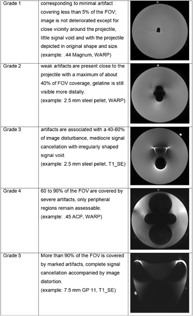 Fairly direct hit! Advances in imaging of shotgun projectiles in MRI ...