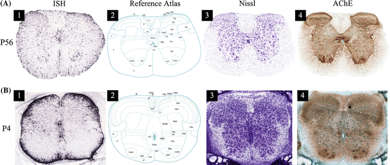 High-resolution gene expression atlases for adult and developing mouse ...