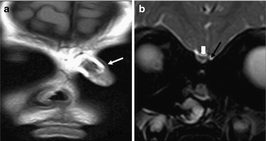 Proboscis lateralis | SpringerLink