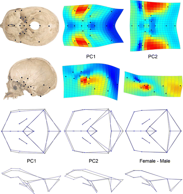 Skull base embryology: a multidisciplinary review | SpringerLink