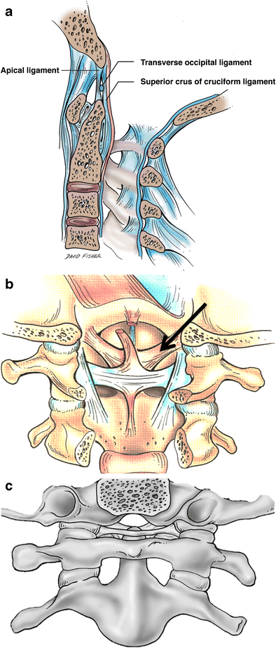 The odontoid process: a comprehensive review of its anatomy, embryology ...