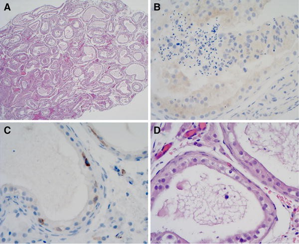 Functional supernumerary testis in a child with testicular torsion and ...
