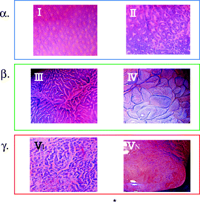 Clinical usefulness of pit patterns for detecting colonic lesions ...