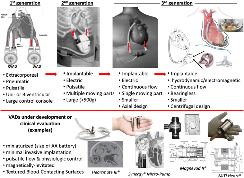 An insight into short- and long-term mechanical circulatory support ...