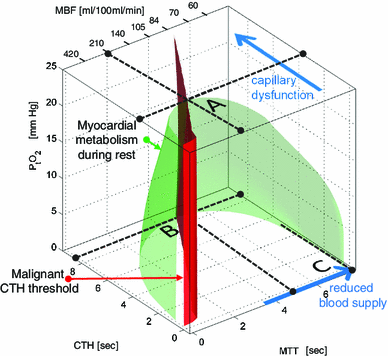 The role of capillary transit time heterogeneity in myocardial ...