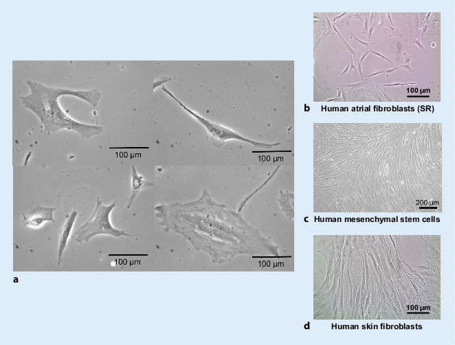 Cardiac fibroblasts | SpringerLink