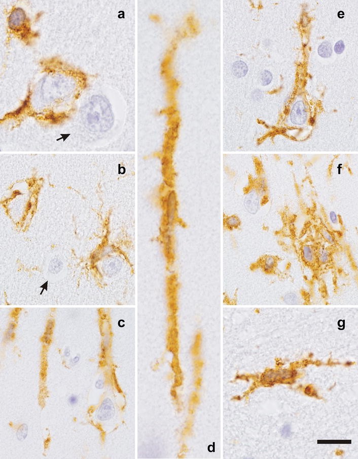 Microglia: biology and pathology | SpringerLink