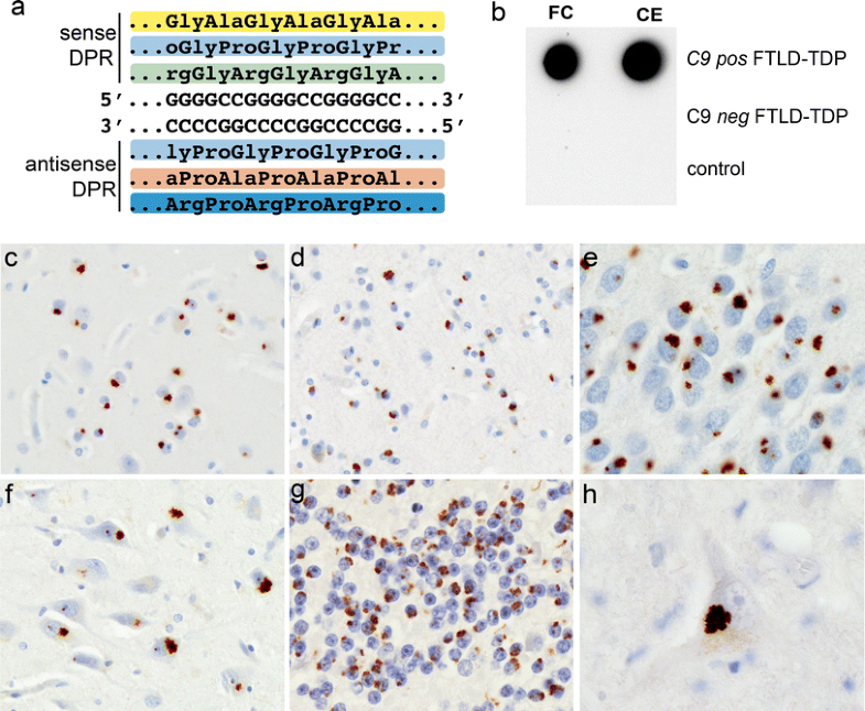 The neuropathology associated with repeat expansions in the C9ORF72 ...