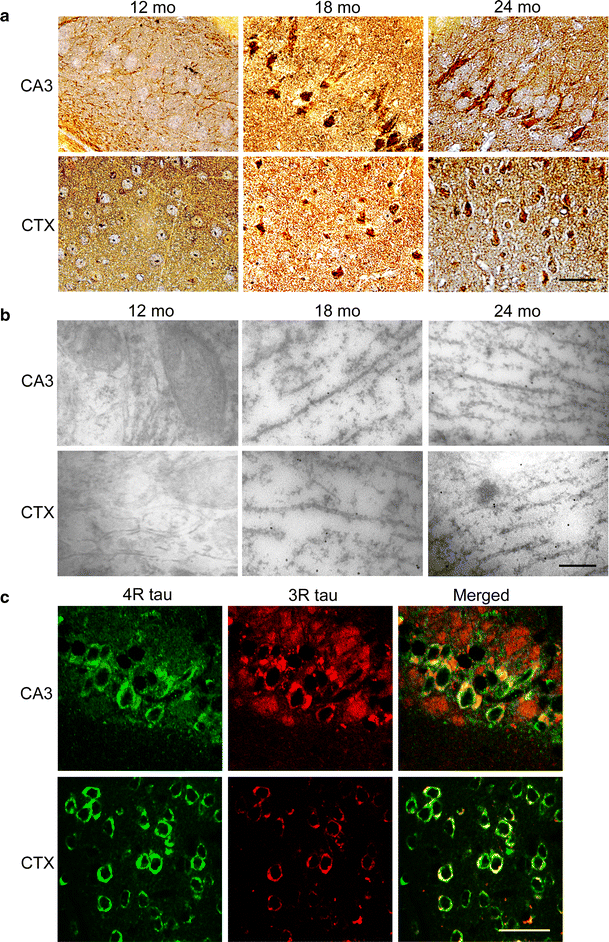 Neurofibrillary tangle formation by introducing wild-type human tau ...