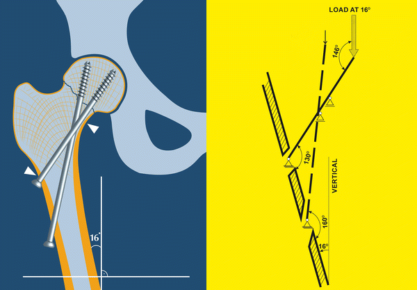 Biomechanics and indications for application of the method of BDSF ...