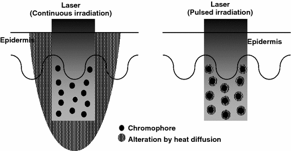 Basics of laser application to dermatology | SpringerLink