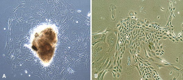 The sebocyte culture: a model to study the pathophysiology of the ...