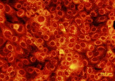 The sebocyte culture: a model to study the pathophysiology of the ...