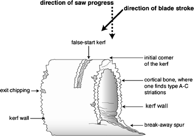 Cutting crime: the analysis of the “uniqueness” of saw marks on bone ...