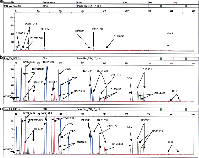 Comparison of three methods of DNA extraction from human bones with ...