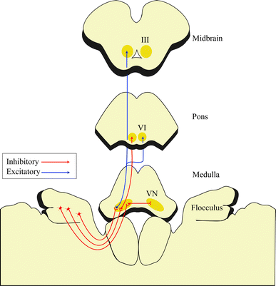 Isolated floccular infarction: impaired vestibular responses to ...