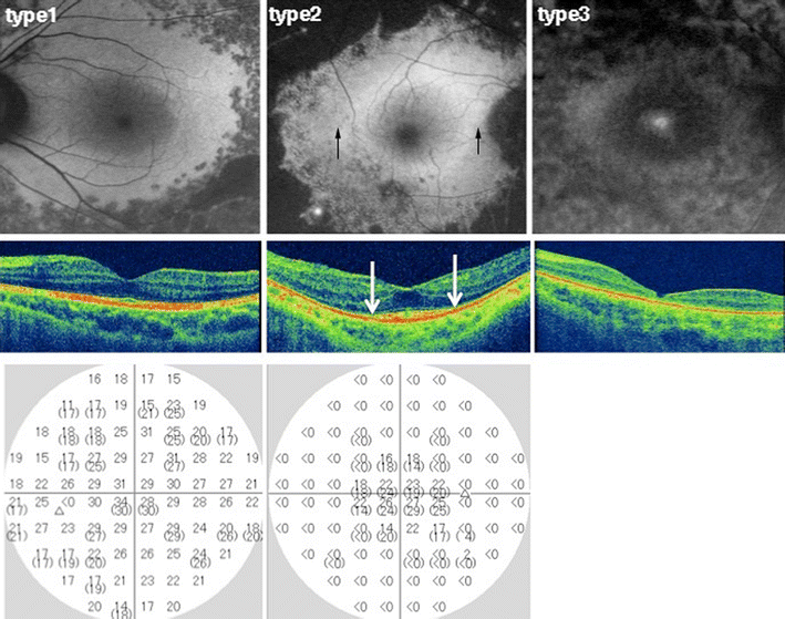 Fundus autofluorescence and retinal structure as determined by spectral ...