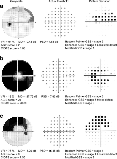 A modified glaucoma staging system based on visual field index ...