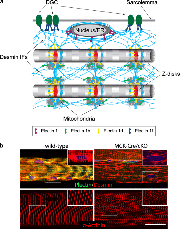 Plectin–intermediate filament partnership in skin, skeletal muscle, and ...