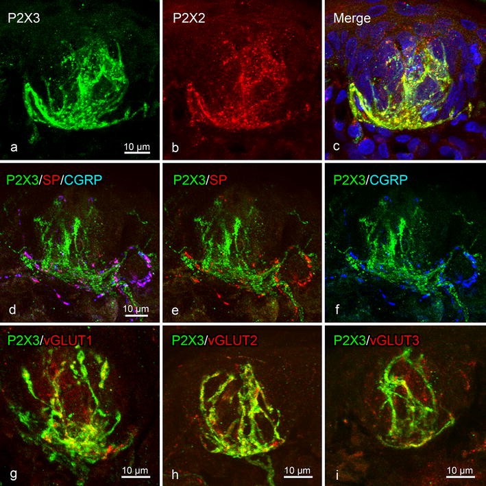 Morphology of P2X3-immunoreactive nerve endings in the rat laryngeal ...