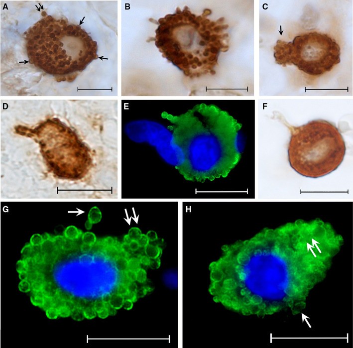 Tryptase as a polyfunctional component of mast cells | SpringerLink