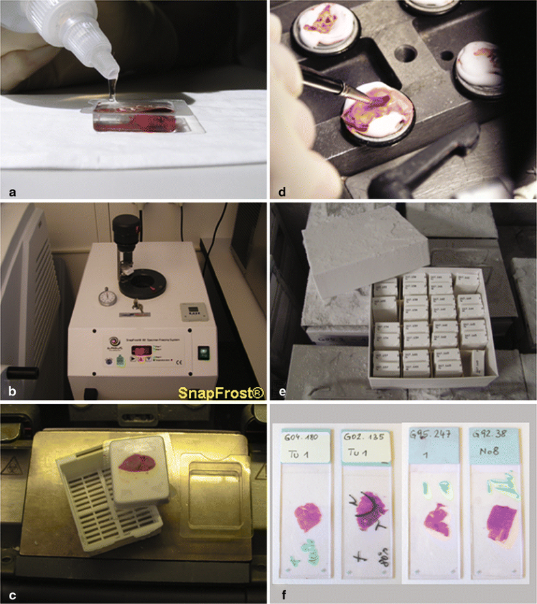 A procedure for tissue freezing and processing applicable to both intra ...