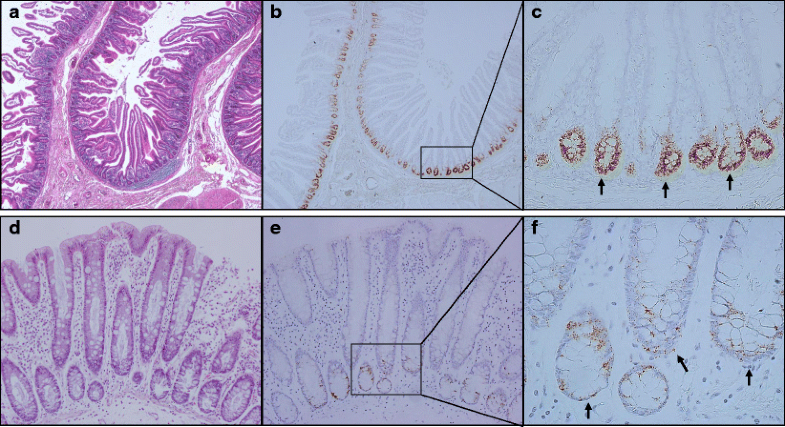 Olfactomedin-related proteins 4 (OLFM4) expression is involved in early ...