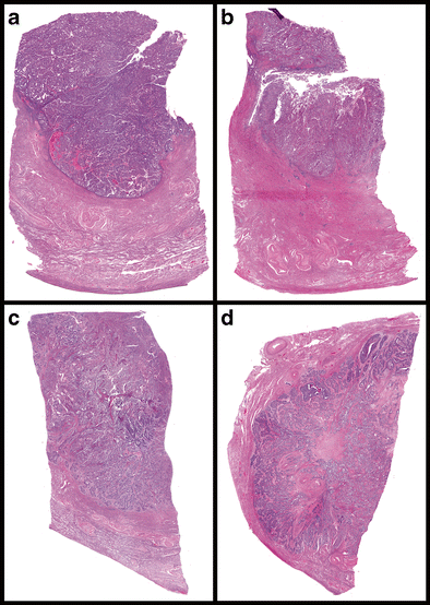Reproducibility of measurement of myometrial invasion in endometrial ...