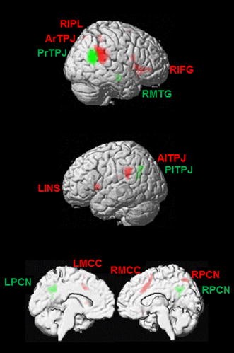 The role of the right temporoparietal junction in attention and social ...