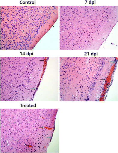 Spleen atrophy related immune system changes attributed to infection of ...