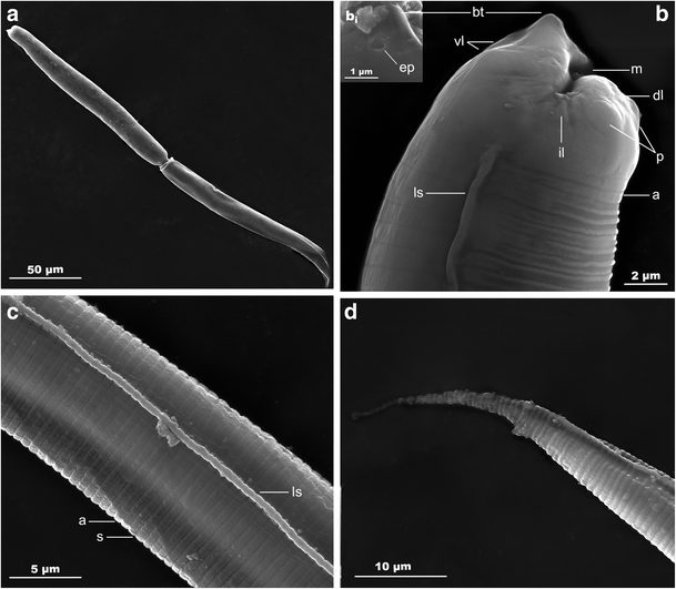 A scanning e lectron microscopy study of ear ly deve lopment in vitro ...
