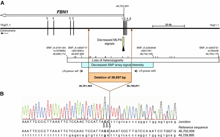 Large genomic fibrillin-1 ( FBN1) gene deletions provide evidence for ...
