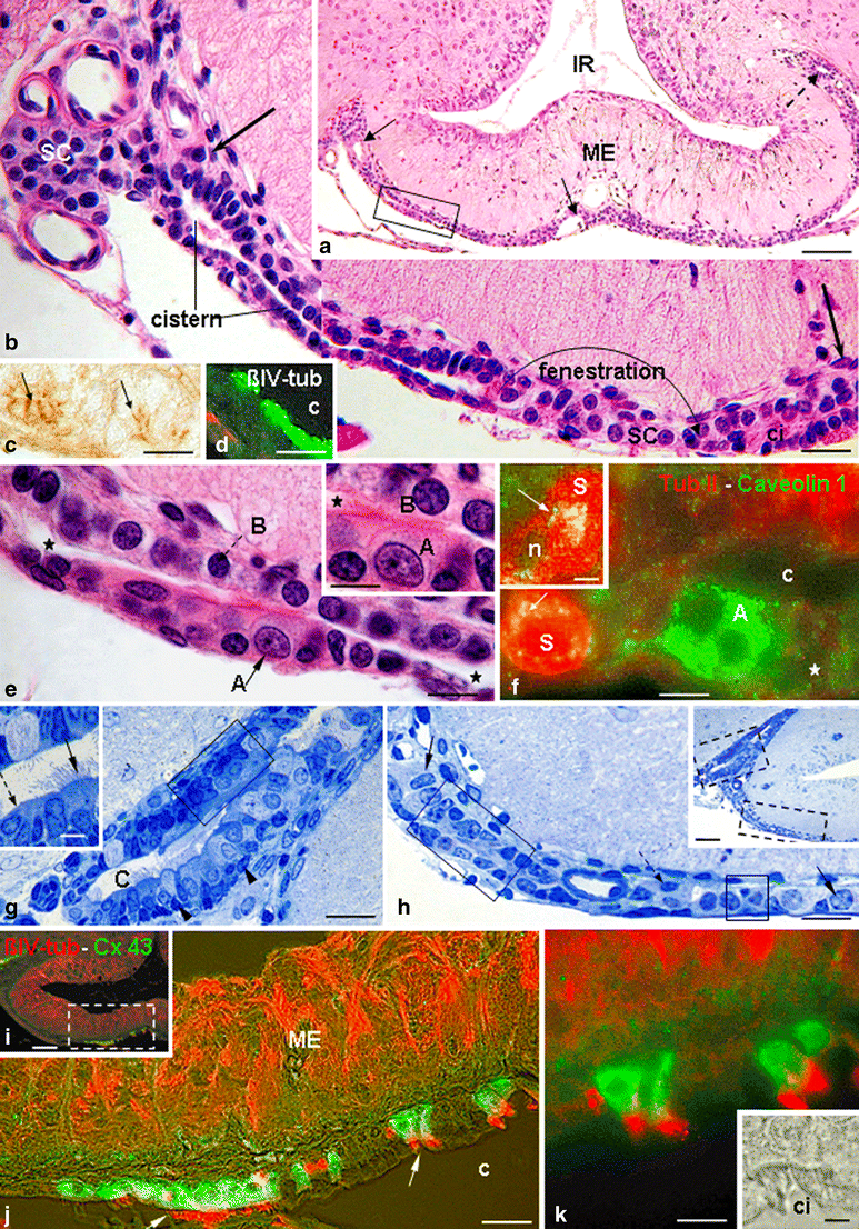 Cell organization of the rat pars tuberalis. Evidence for open ...