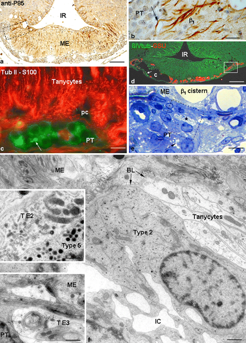 Cell organization of the rat pars tuberalis. Evidence for open ...
