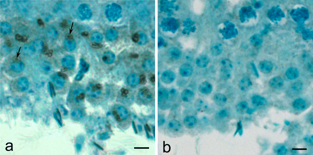 MMP2 and acrosin are major proteinases associated with the inner ...