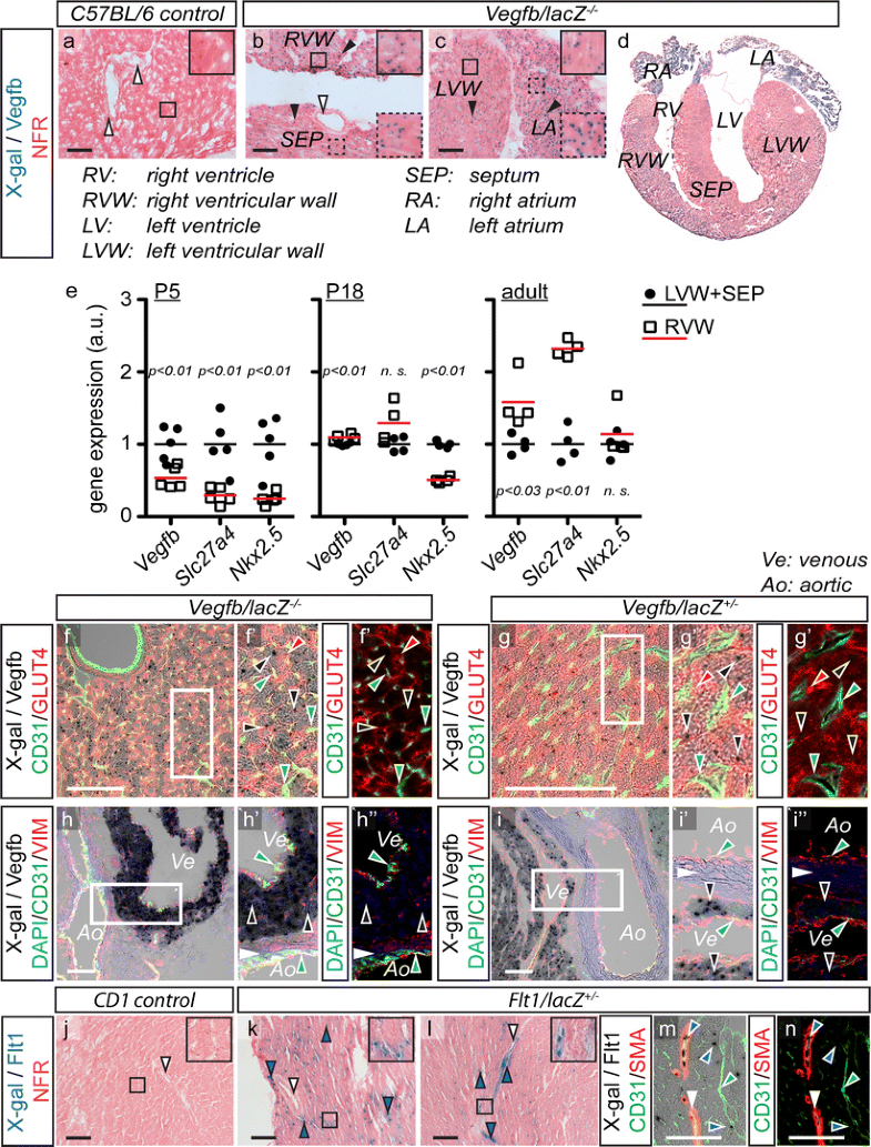 Expression of vascular endothelial growth factor (VEGF)-B and its ...