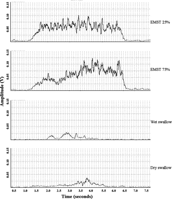 Surface Electromyographic Activity of the Submental Muscles During ...